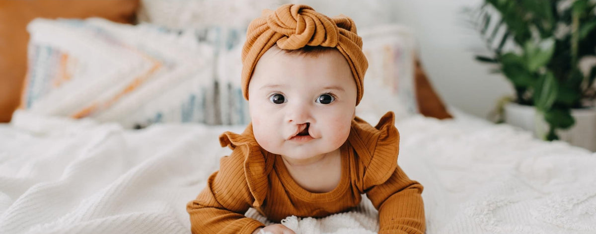9 Tips for the First Year of Your Baby's Cleft Journey – CozeeCoo